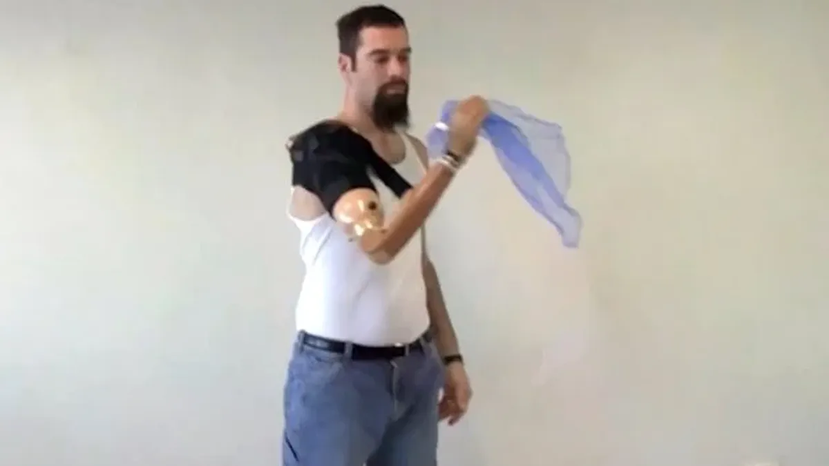 El hombre manco que puede agarrar un pañuelo al vuelo