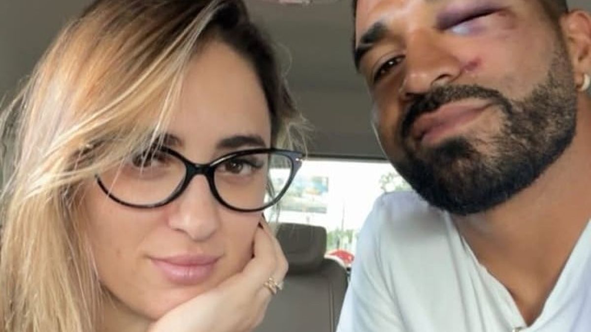 El duro golpe que recibió el uruguayo Rodrigo Aguirre: mirá el impacto, cómo le quedó la cara y ...