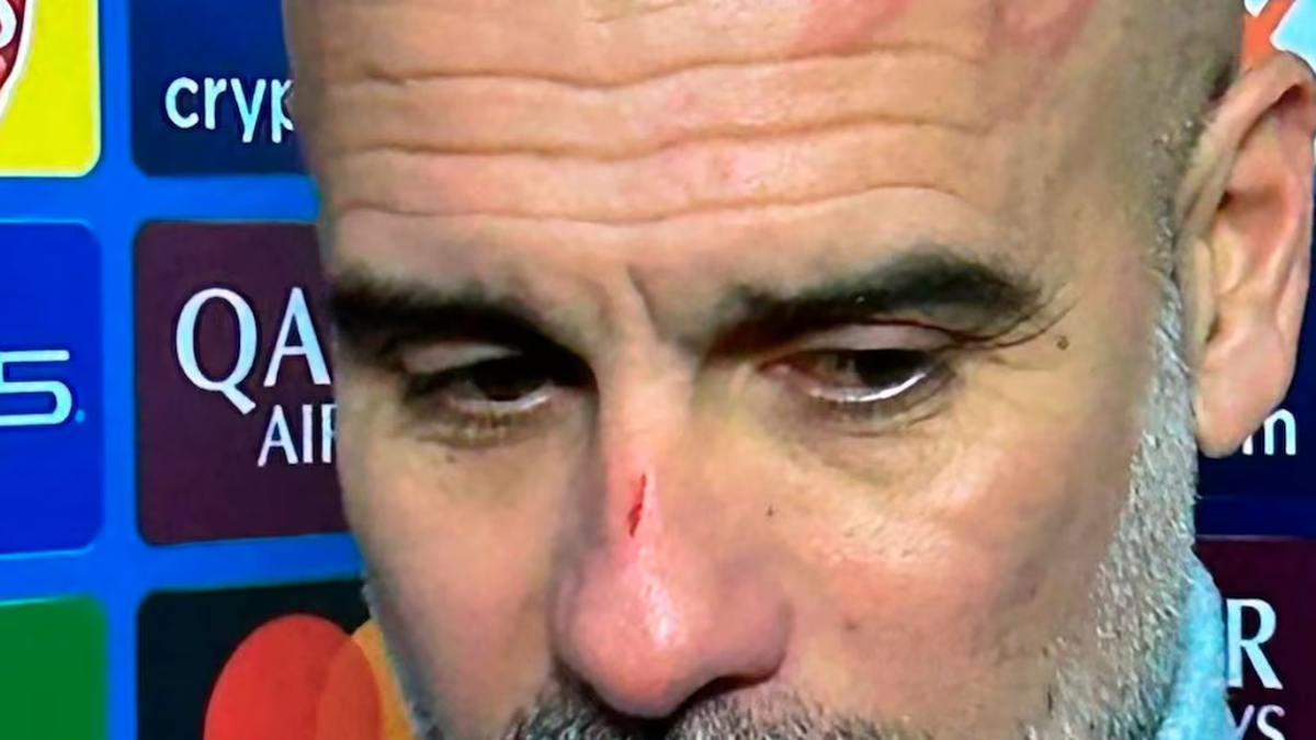 Guardiola aparece con arañazos tras el empate del City con el Feyenoord ...
