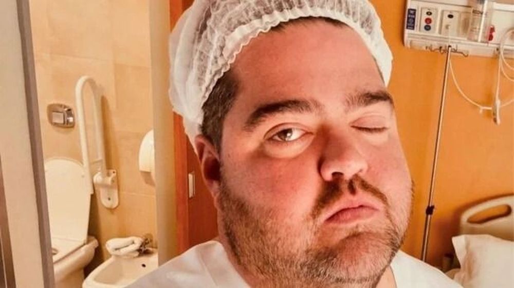 Darío Barassi fue hospitalizado nuevamente de urgencia después de su ...